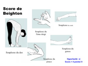 Rhumatologie – Syndromes de Marfan et apparentés